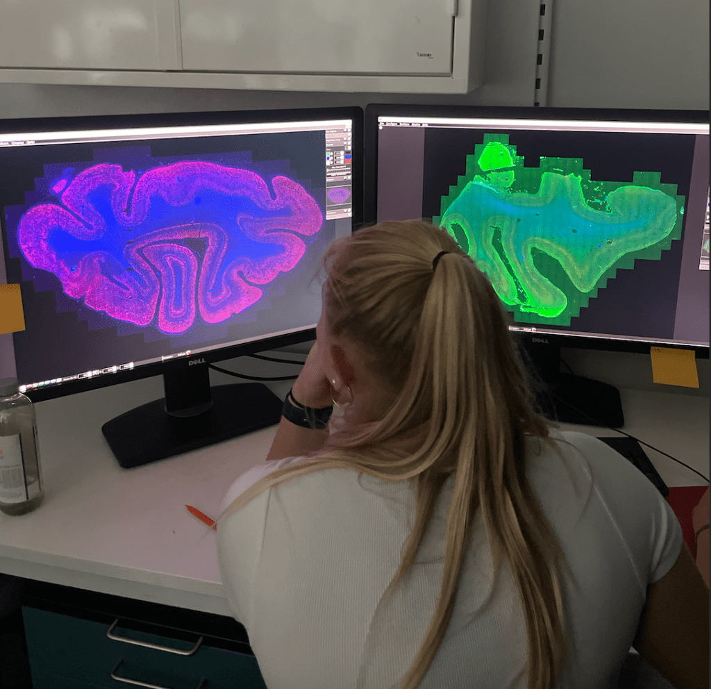 Mapping the Human Protein Atlas: Inside the Brain Profiling Lab at ...