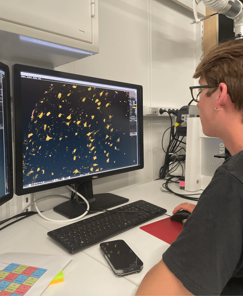 Mapping the Human Protein Atlas: Inside the Brain Profiling Lab at ...